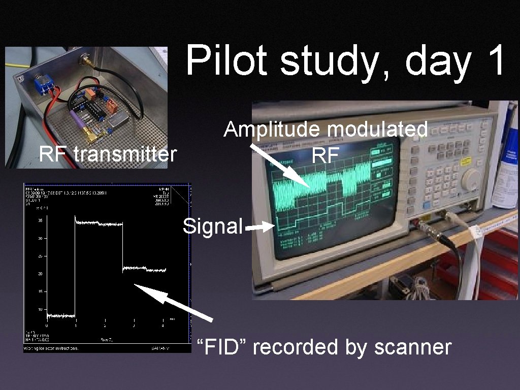 Recording of EEG by MRI Your scanner can