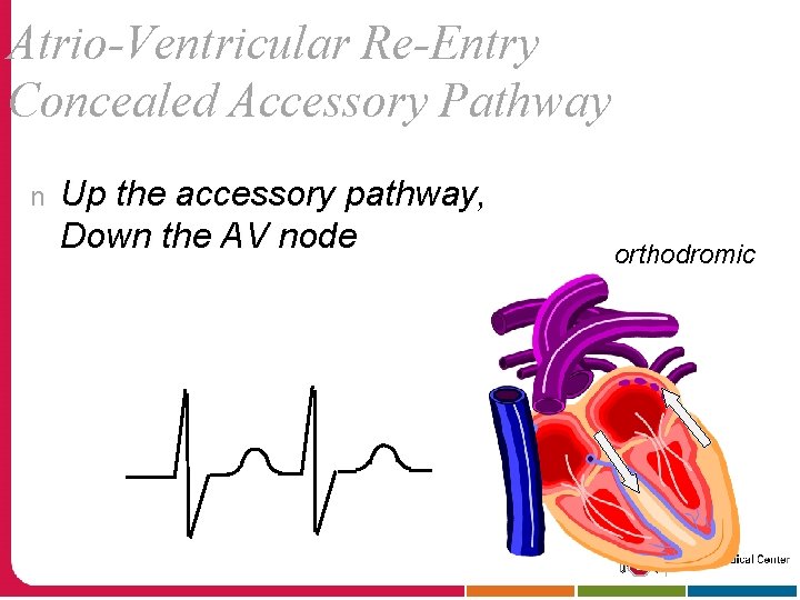 Mechanism of Arrhythmia Fellow School Lecture Series Mahmoud