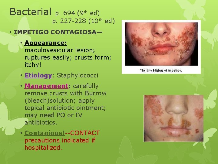 Infections of the Skin Lice Scabies Pinworm Ringworm