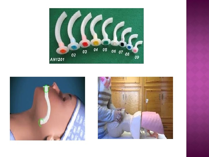 Pediatric Emergency Definition Causes Diagnosis 1 basic life