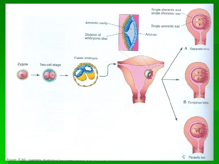 FETAL MEMBRANES UMBILICAL CORD Initially connecting stalk Blood
