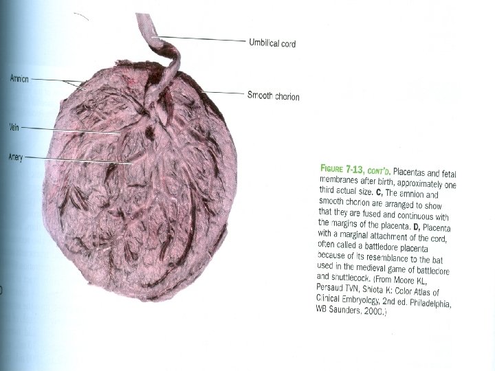 FETAL MEMBRANES UMBILICAL CORD Initially connecting stalk Blood