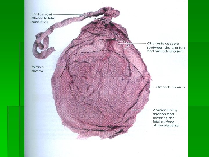 FETAL MEMBRANES UMBILICAL CORD Initially connecting stalk Blood