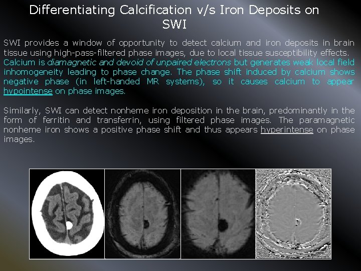 Cerebral Microbleeds Causes Clinical Relevance and Imaging Approach