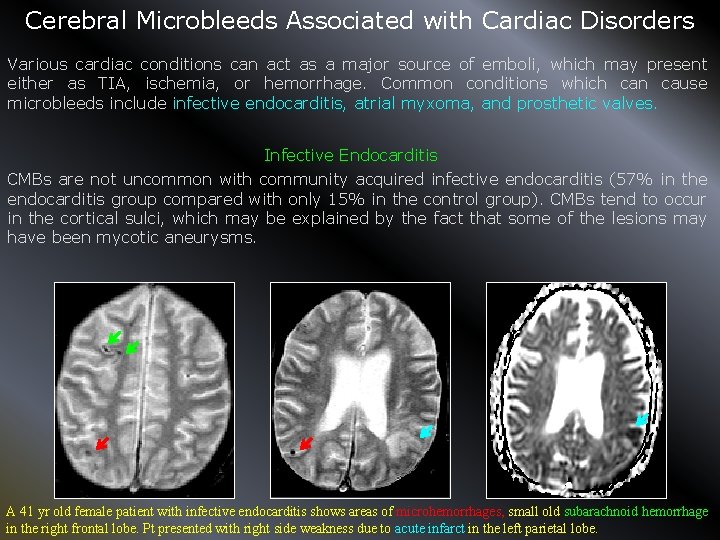 Cerebral Microbleeds Causes Clinical Relevance and Imaging Approach
