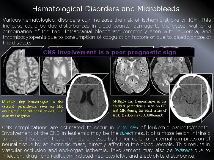 Cerebral Microbleeds Causes Clinical Relevance and Imaging Approach