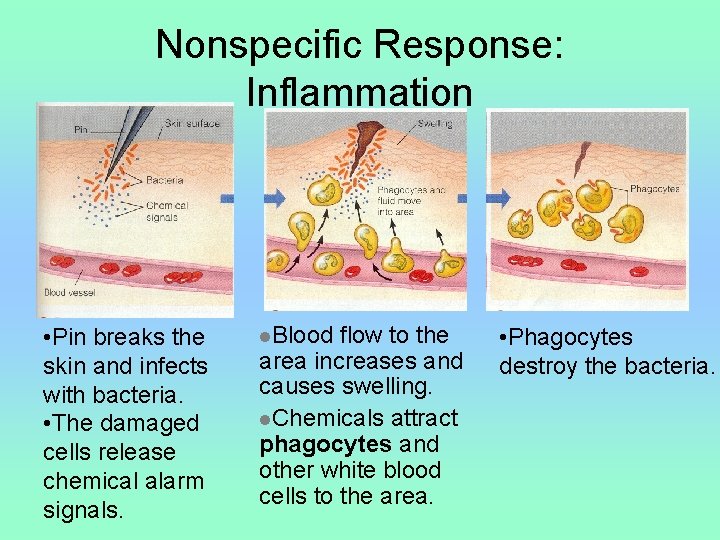 Immune Response LN 13 Body Response Your body