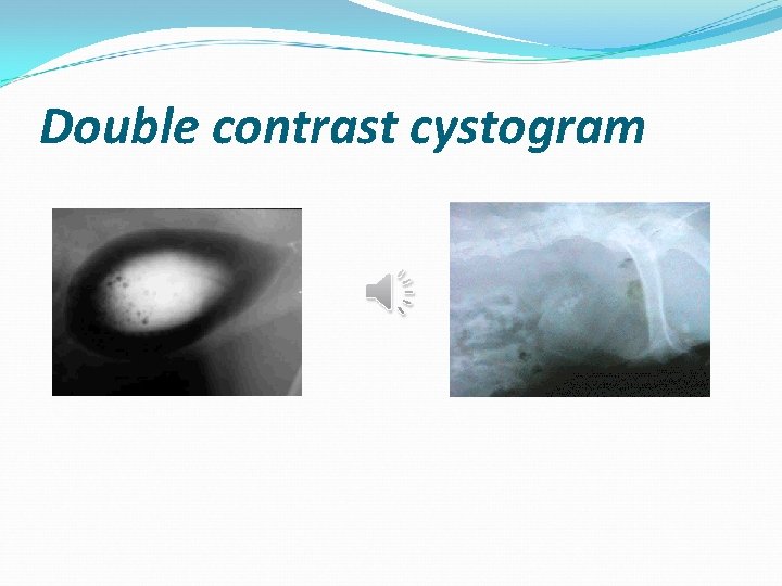 RADIOLOGICAL PATHOLOGY OF ABDOMENUROGENITAL SYSTEM INTRODUCTION ...