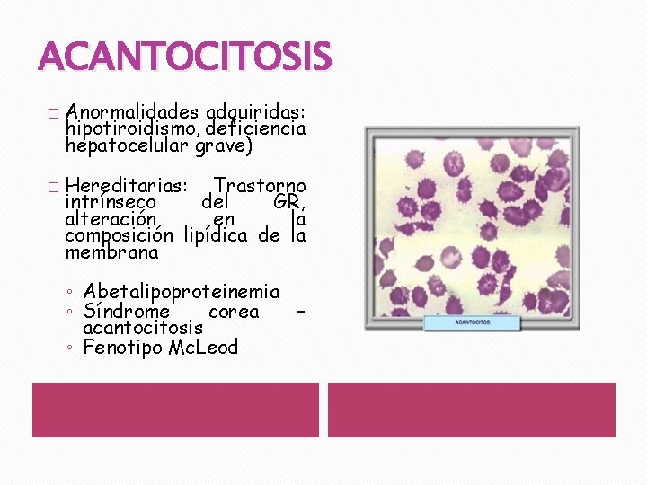 ANEMIA HEMOLITICA DEFECTOS DE MEMBRANA DIANA VERA FRANCY