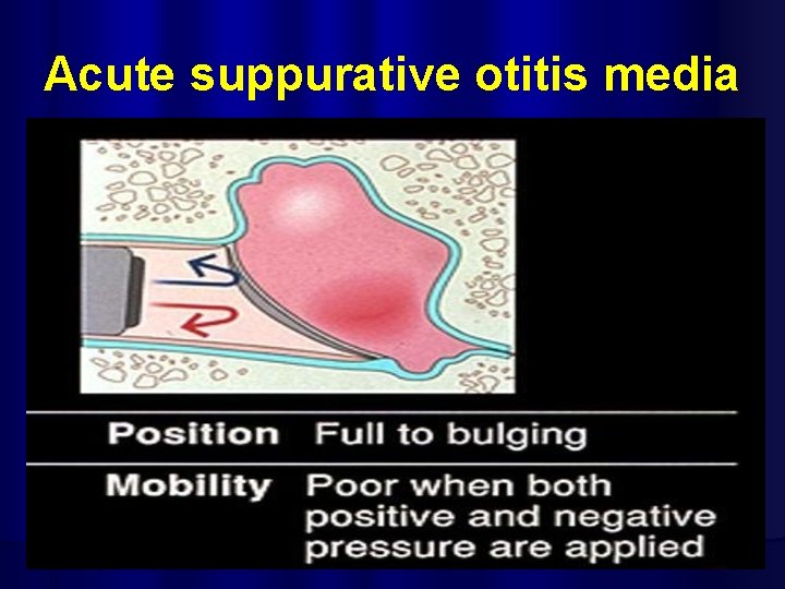 Anatomy Physiology of Eustachian Tube Dr Vishal Sharma