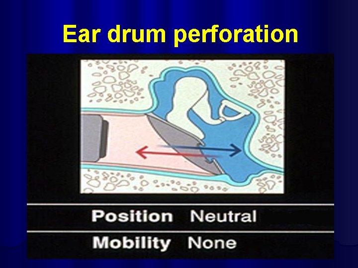 Anatomy Physiology of Eustachian Tube Dr Vishal Sharma