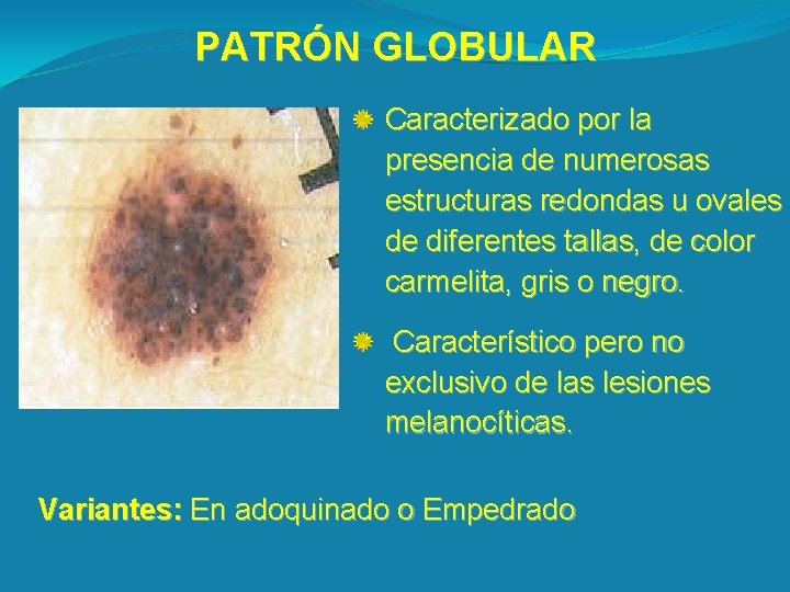 SUMARIO PATRONES DERMATOSCPICOS 1 Definicin 2 Significado diagnstico