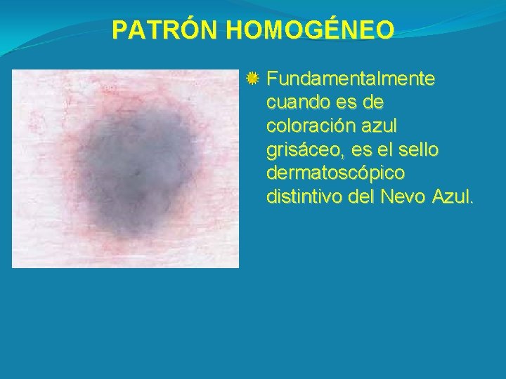 SUMARIO PATRONES DERMATOSCPICOS 1 Definicin 2 Significado diagnstico