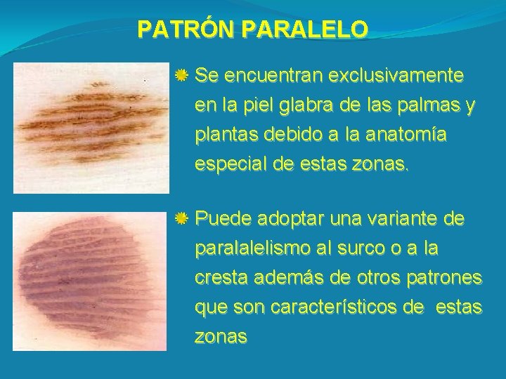 SUMARIO PATRONES DERMATOSCPICOS 1 Definicin 2 Significado diagnstico