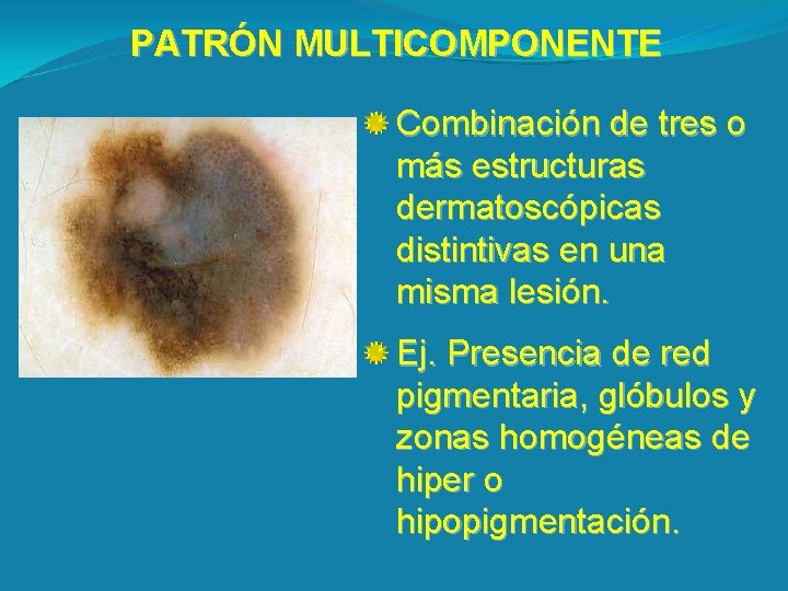 SUMARIO PATRONES DERMATOSCPICOS 1 Definicin 2 Significado diagnstico