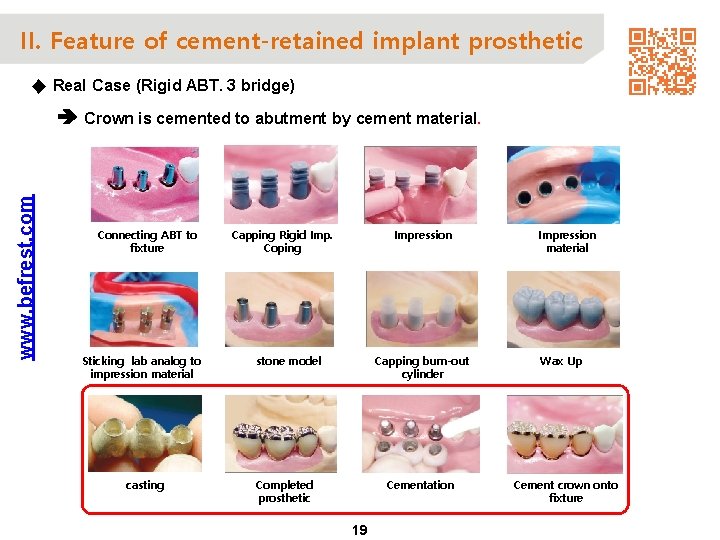 Classification of implant prosthetics 1 www befrest com