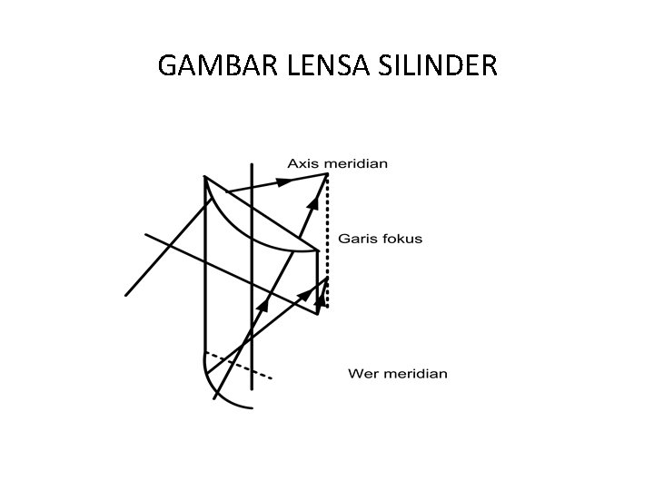 KELAINAN REFRAKSI BAGIAN I K MATA FAKULTAS KEDOKTERAN