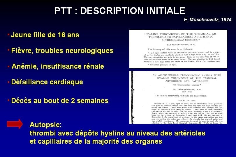 MICROANGIOPATHIES THROMBOTIQUES PHYSIOPATHOLOGIE CLASSIFICATION Paul ...