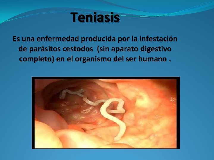 TENIASIS Teniasis Es una enfermedad producida por la