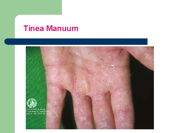 Fungal Infection of the Skin Dr Mohamad Nasr