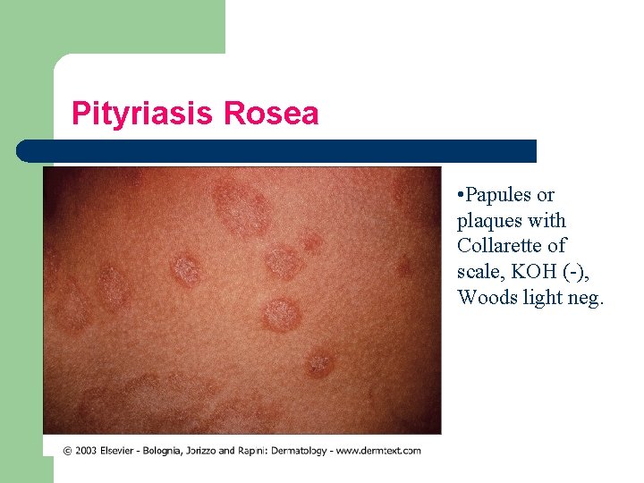 Fungal Infection of the Skin Dr Mohamad Nasr