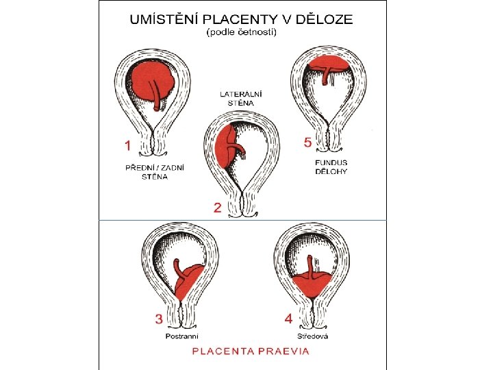EMBRYOLOGIE 2 Vvoj extraembryonlnch struktur extraembryonln mezoderm ...