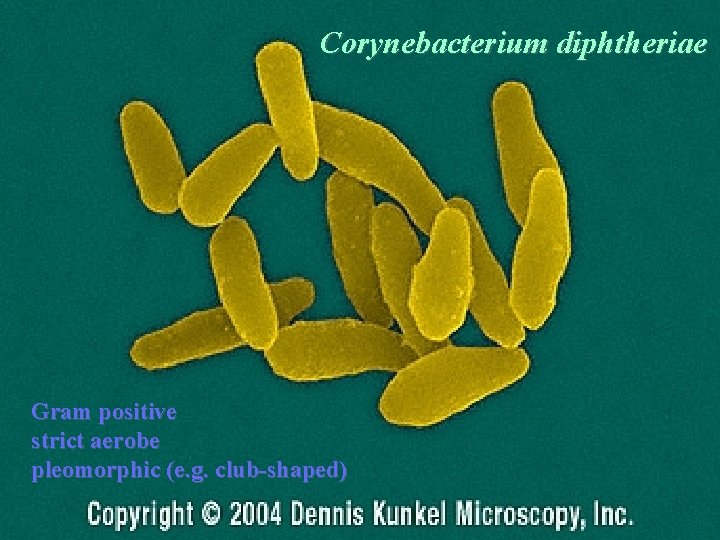 MYCOBACTERIA CORYNEBACTERIA Lecture 40 Faculty Dr Alvin Fox