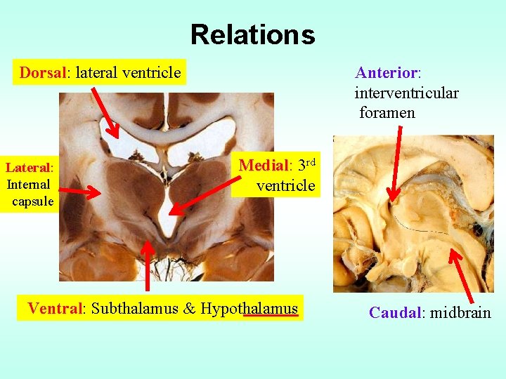 1 The Thalamus is a Scanner All information