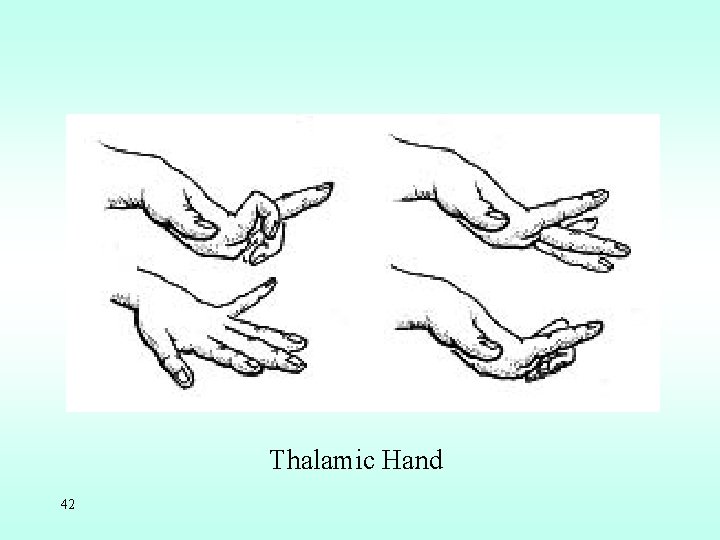 1 The Thalamus is a Scanner All information