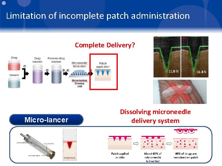 Microneedles Next Generation of Drug Delivery JUVIC Biotech