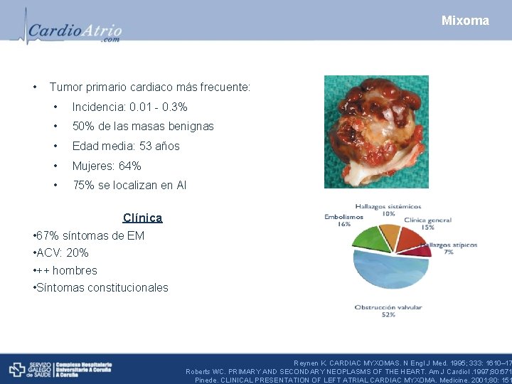 Tumores Cardiacos Dr Juan A Sieira R Moret