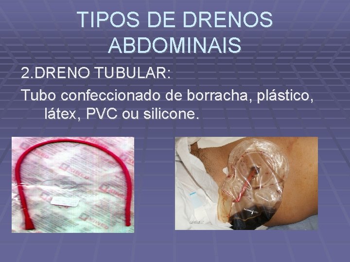 DRENOS SERVIO DE EDUCAO EM ENFERMAGEM www uftm