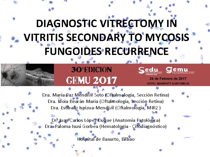 DIAGNOSTIC VITRECTOMY IN VITRITIS SECONDARY TO MYCOSIS FUNGOIDES