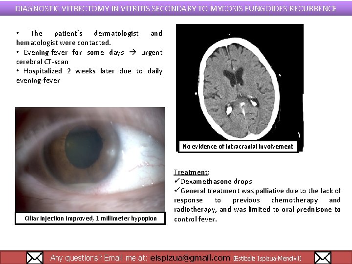 DIAGNOSTIC VITRECTOMY IN VITRITIS SECONDARY TO MYCOSIS FUNGOIDES