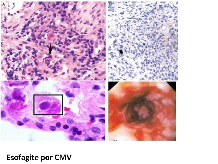 Encontro 6 Doena do trato digestrio 1 Esfago