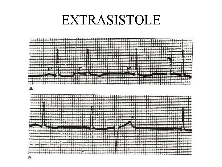 APPARATO CARDIOCIRCOLATORIO IL CUORE CUORE Valvole atrioventricolari ...