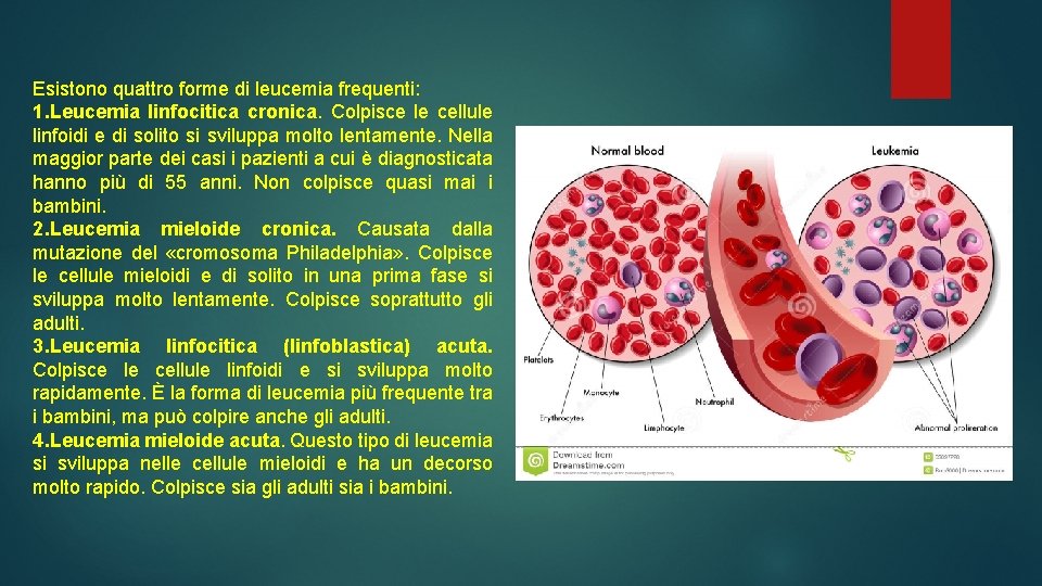 Leucemia Cos e cosa la causa La leucemia