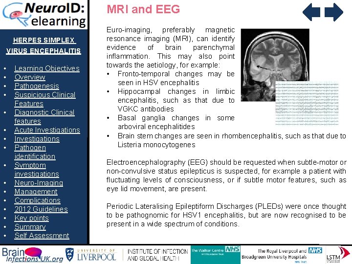 HERPES SIMPLEX VIRUS ENCEPHALITIS Learning Objectives Overview Pathogenesis