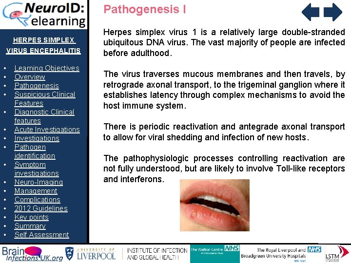 HERPES SIMPLEX VIRUS ENCEPHALITIS Learning Objectives Overview Pathogenesis
