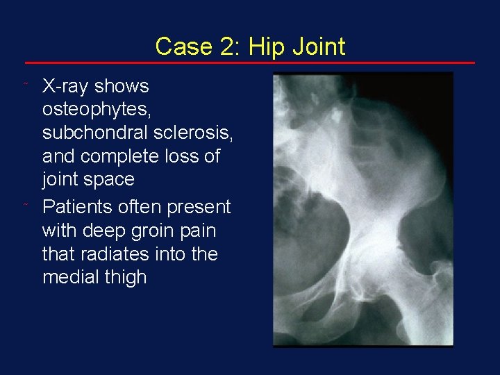 High Impact Rheumatology Evaluation and Management of Osteoarthritis