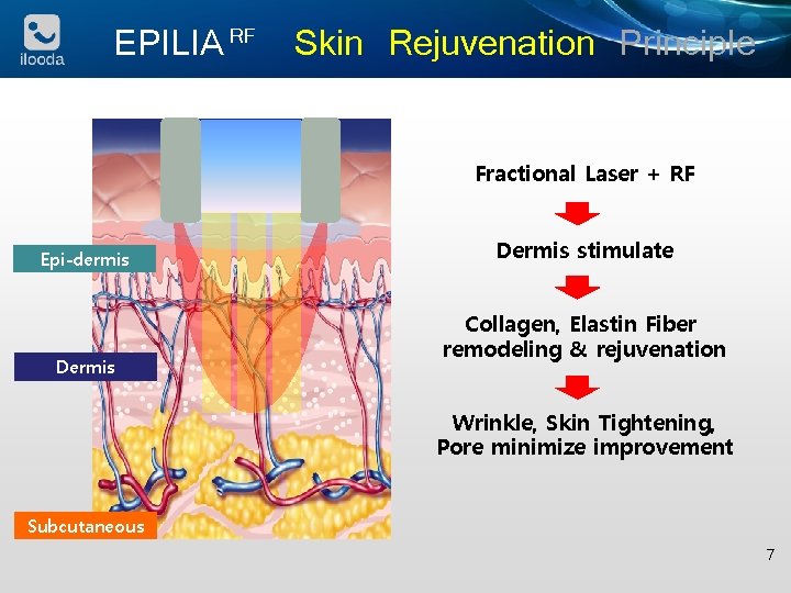 Hair removal system for most skin type and