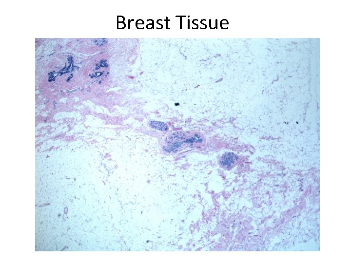 Histology for Pathology Female Genital Tract and Breast