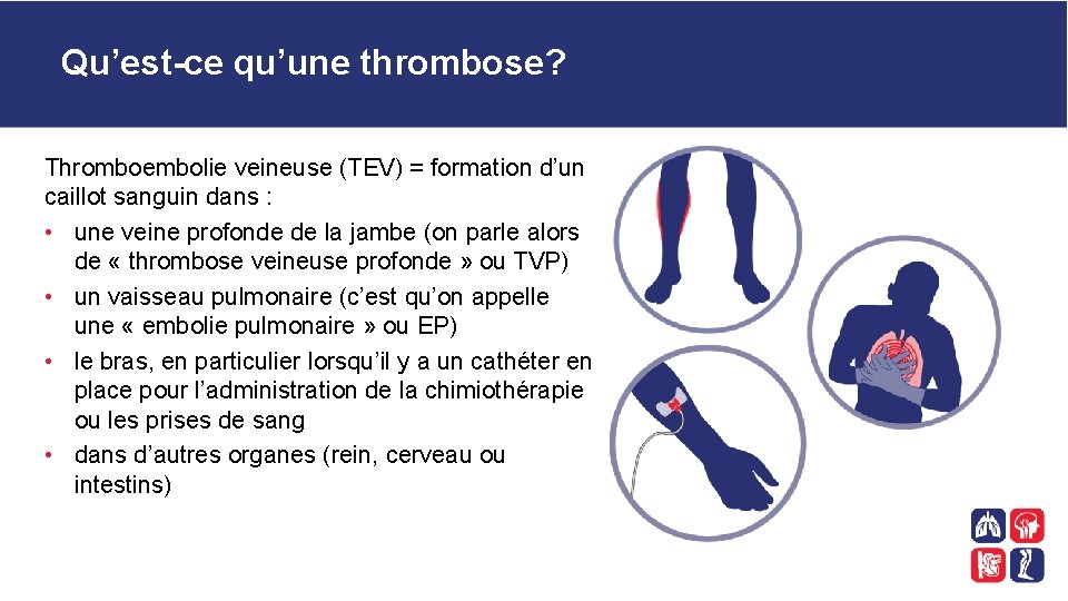 Savoir reconnatre la thrombose associe au cancer Divulgation