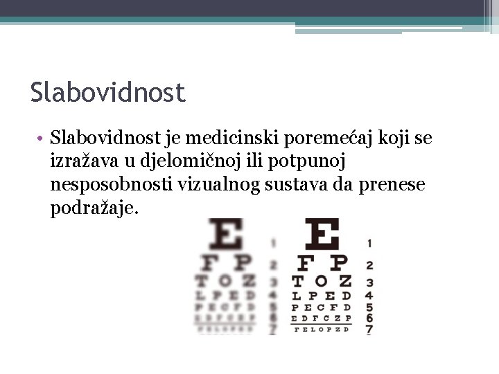 Komunikacija sa slabovidnim pacijentom Slabovidnost Slabovidnost je ...