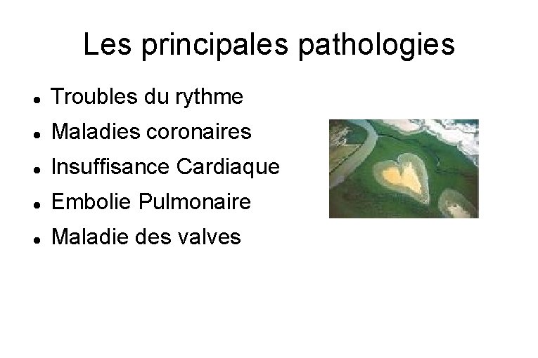 Pathologie Cardiaque Les principales Les principales pathologies Troubles