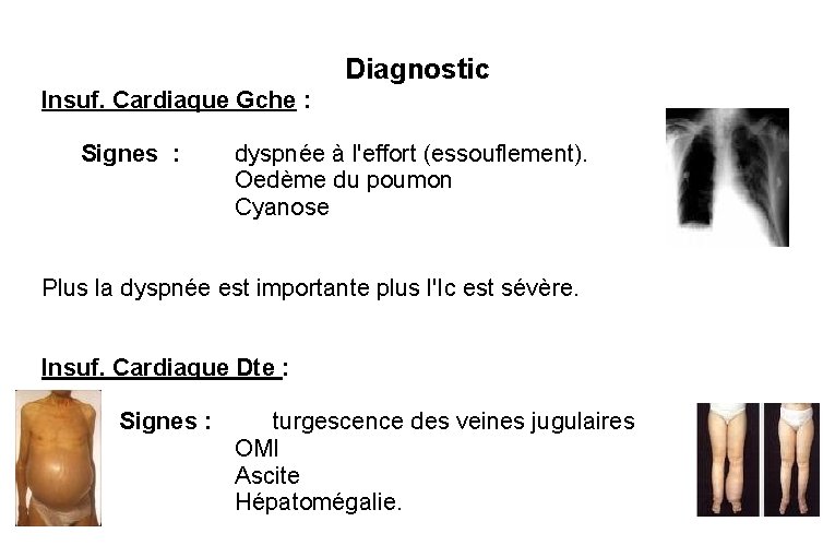 Pathologie Cardiaque Les principales Les principales pathologies Troubles
