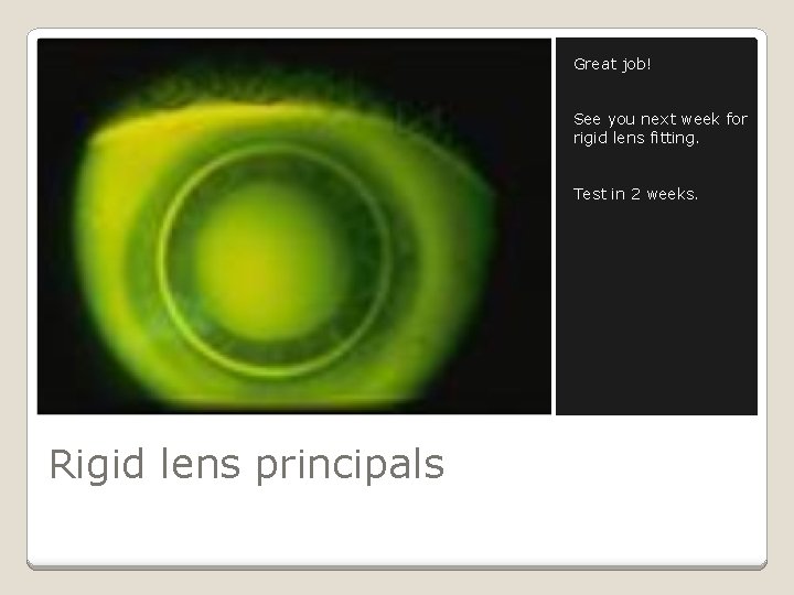 Rigid lens principals and products Week 9 Rigid