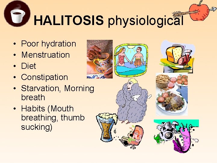 Oral Malodor 4 Classes 3 Subtypes Above Carina