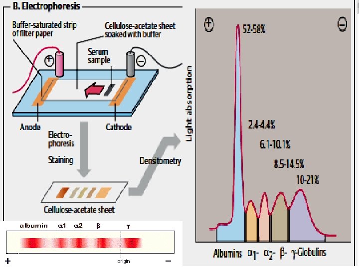 Plasma Proteins Overview Electrophoretic patterns of plasma proteins