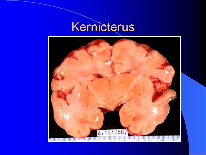LESION CELULAR ASPECTOS PATOLGICOS v CAUSA ETIOLOGIA v